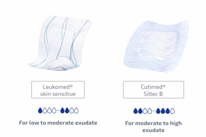 Skin tears – a serious issue