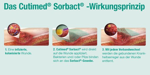 Therapiekonzept und Produkte zur chronischen Wundversorgung