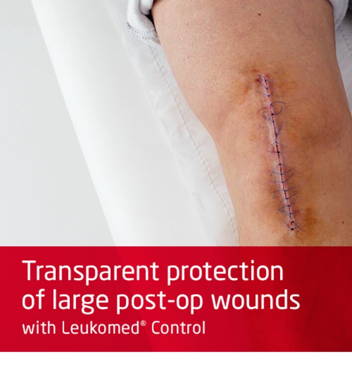 Leukoplast® helps to protect your surgical results from SSIs