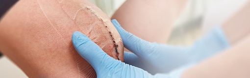 Operationswunden: Optimale Wundversorgung & Pflege nach OP