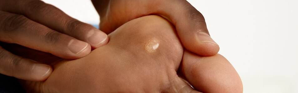Wound care for blisters: discover the Leukoplast choices!