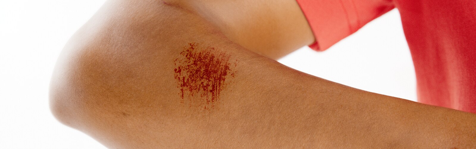 Wound care for scratches: discover the Leukoplast solutions!