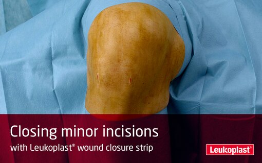 Leukoplast wound closure strip – fast and simple wound closure
