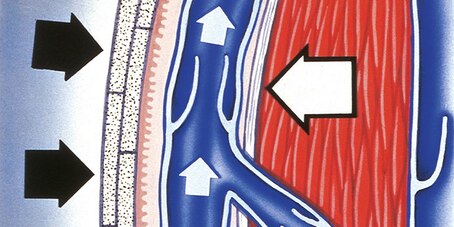 Compression for Lymphoedema and Venous Health | JOBST