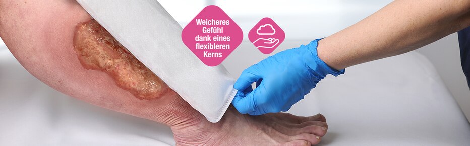Superabsorberverband – Cutimed Sorbion für chronische Wunden
