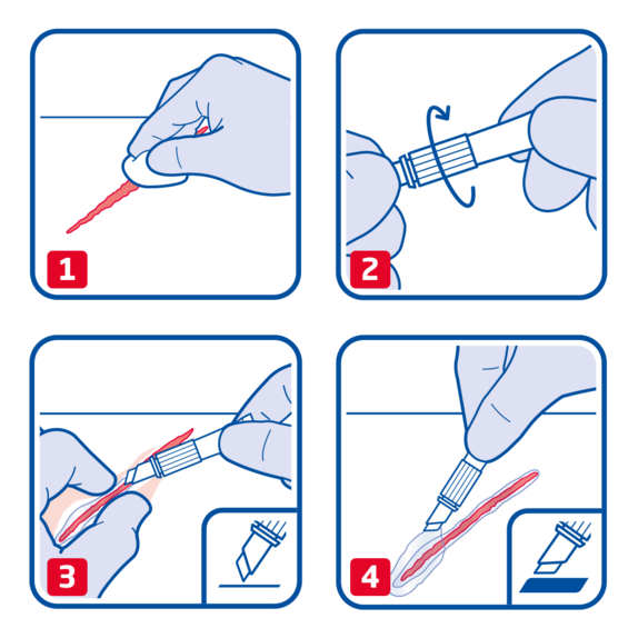 Tissue adhesive glue with a 2 in 1 applicator for quick and easy, non ...