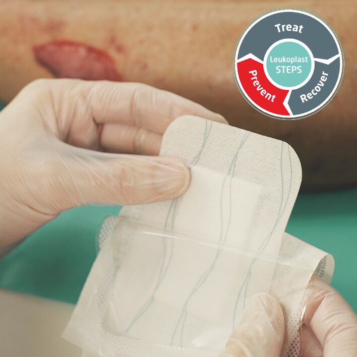 Skin tears – what they are and what you can do about them