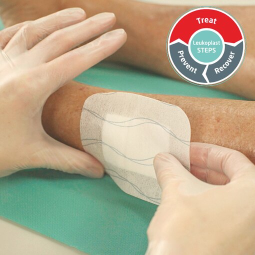 Skin tears – what they are and what you can do about them