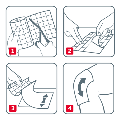 Hypafix – stretchable and flexible wide area fixation