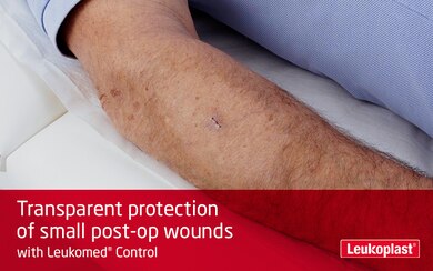 Leukomed Control – sterile, transparent, absorbent dressing for acute ...