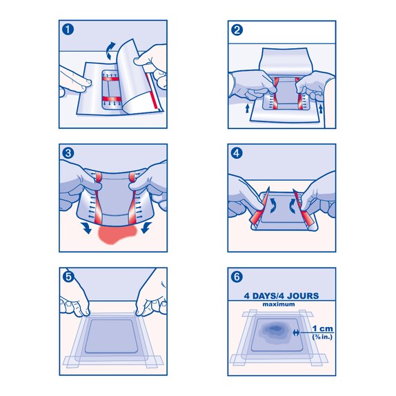 Cutimed Sorbact Hydroactive—bacteria and fungi binding dressing