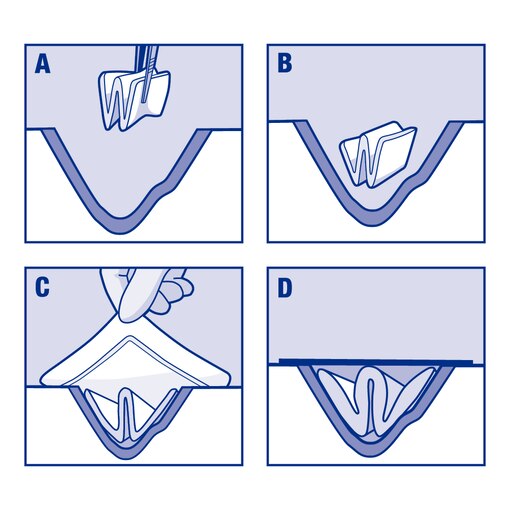 Cutimed® Cavity - Absorbent Foam Dressing for Deep Wounds