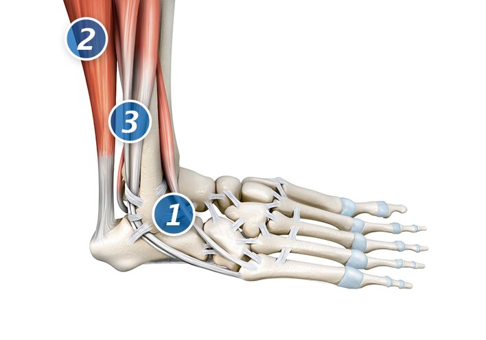 Choosing the Right Ankle Support for your Condition | Actimove