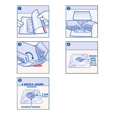 Cutimed® Sorbact® Hydroactive B—a bacteria binding, absorbent gel ...
