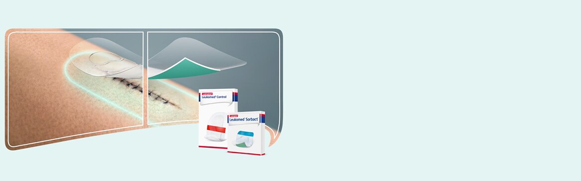 Leukoplast Wound care in best hands