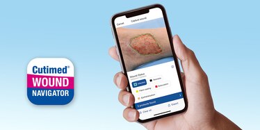Cutimed® offers reliable support in managing chronic wounds