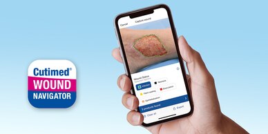 Cutimed® offers reliable support in managing chronic wounds