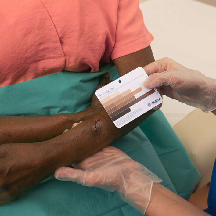 Skin Tears: Assessment and Care for All Skin Tones