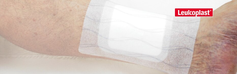 Cutimed Sorbact Swab—bacteria and fungi binding wound dressing