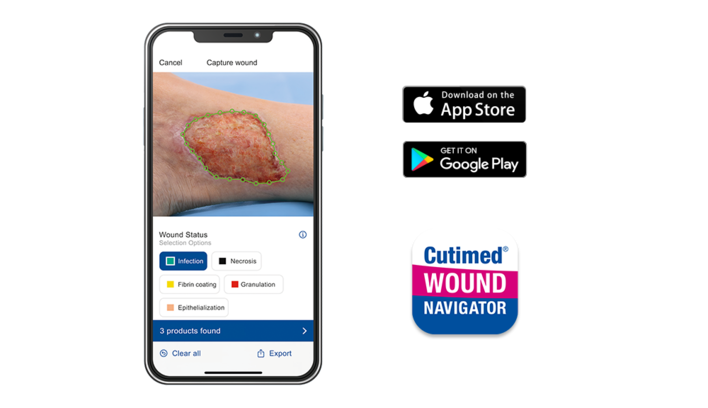 Informazioni per la cura delle ferite croniche | Cutimed