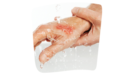 Quais são os 7 tipos de feridas | Leukoplast