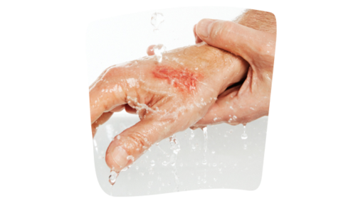 Quali sono i 7 tipi di ferite comuni e come trattarli - Leukoplast