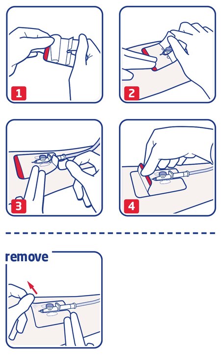 Leukomed IV film – IV dressing for intravenous injection sites